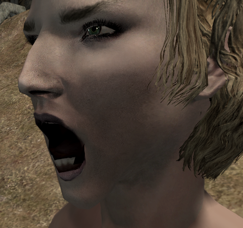 Female Mouths Opening Wide Teeth Not Following Far Enough Technical