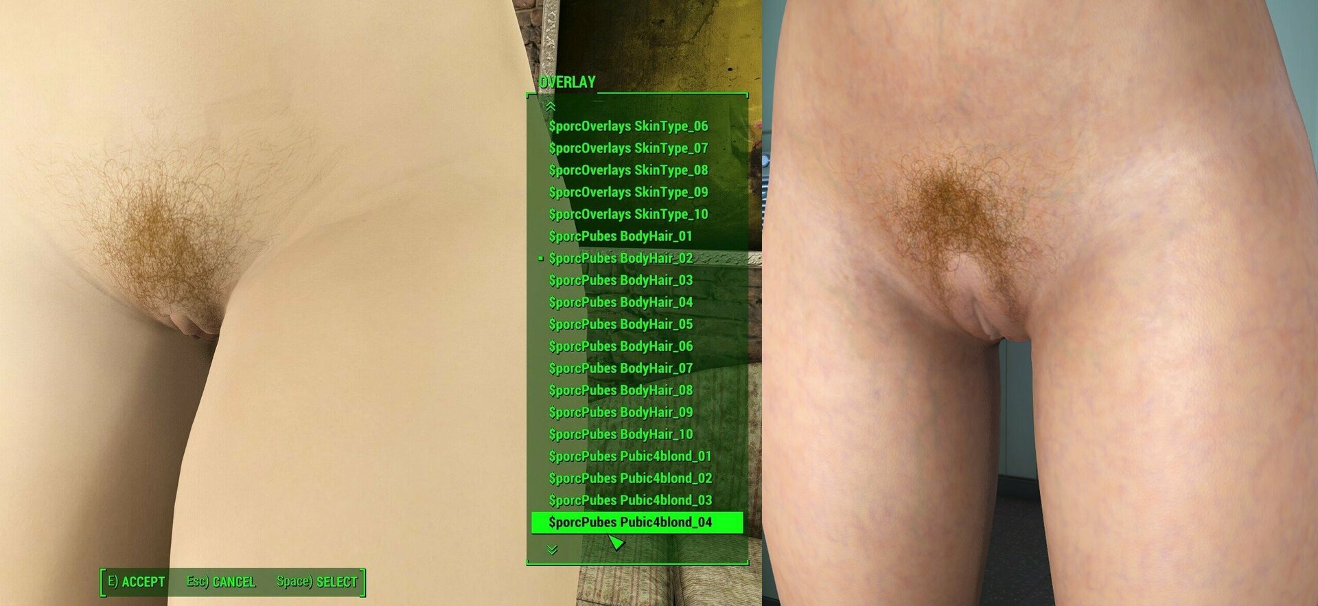 Porcupines Skin Overlays Page 2 Downloads Fallout 4 Adult And Sex